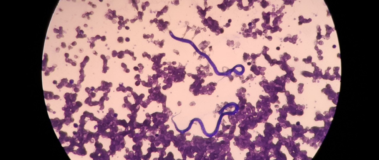 [Webinar] Heartworm: Current Trends and Updates on Diagnosis and ...