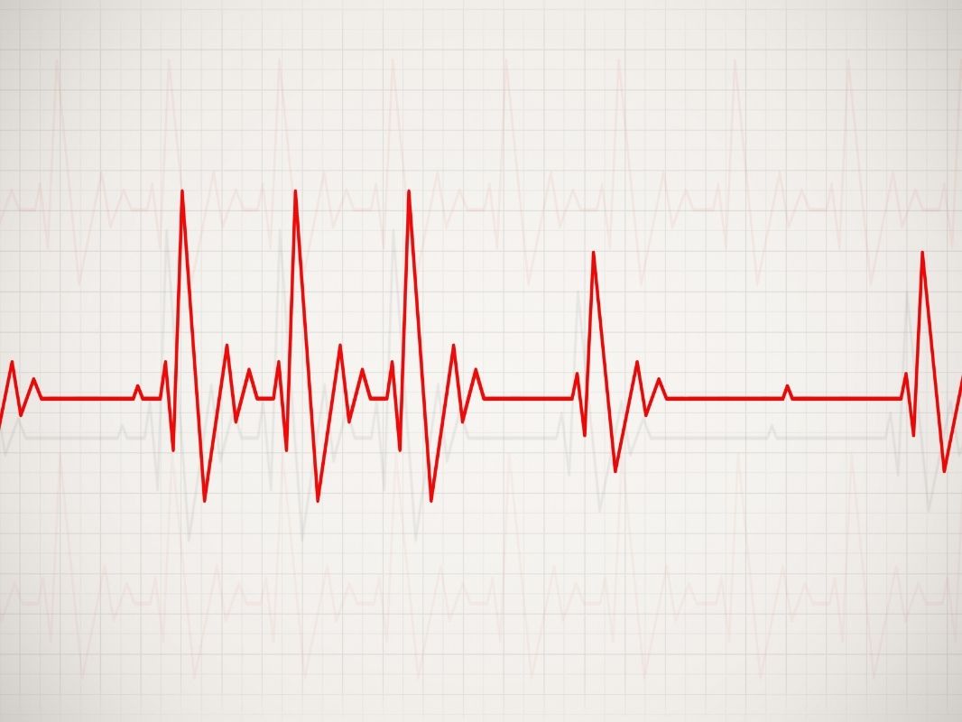 [Webinar] Approach to Emergent Arrhythmias – Vetcetera