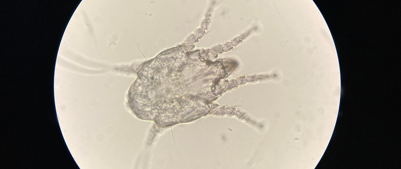 [Webinar] Parasitology Part 2: Microscopic parasite identification ...